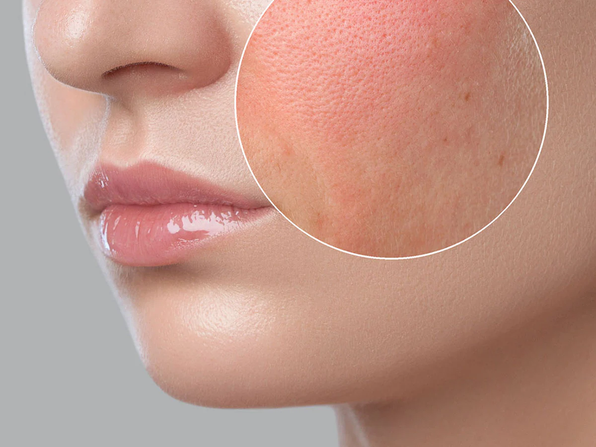 Dry Skin DIY: 10 Moisture Miracle Remedies for Blissful Hydration ...