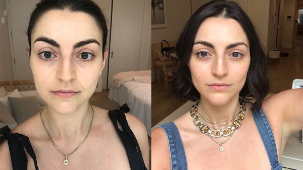 Before and After NuFACE: Real Results from Microcurrent Treatments ...