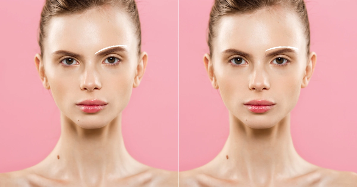How to Fix an Asymmetrical Face: Causes, Treatments & Natural Remedies ...